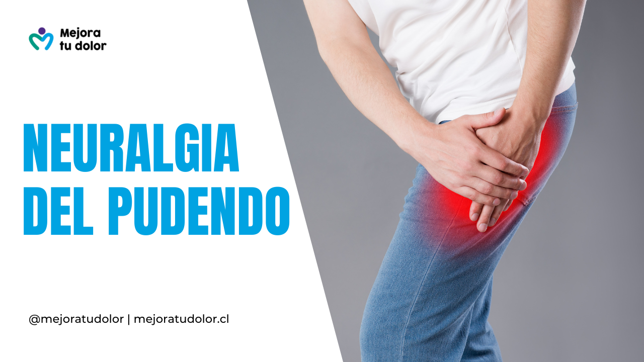 Dolor por Neuralgia del Pudendo ¿De qué se trata? – Mejora Tu Dolor